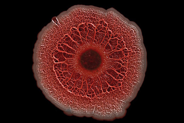 New drug uses immune system to wipe out deadly bacteria | Delano News