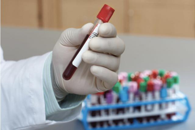 Siemens Healthineers ferme Fast Track Diagnostics | Paperjam News